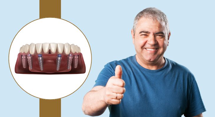 Multiple Teeth Implants in Delhi, India - Veda Dentistry